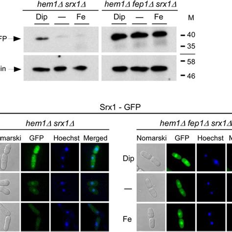 Analysis Of Srx1‐gfp Protein Steady‐state Levels And Its Localization