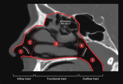 1 Sagittal Cross Section From A Ct Scan Showing The Structural Elements Download Scientific