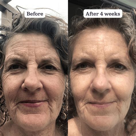 Stem Cell Concentrate Advanced Spermidine Anti Ageing Formula Edible Beauty Australia