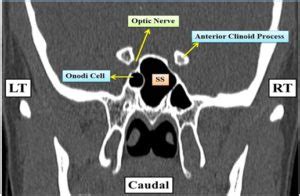 Ajns African Journal Of Neurological Sciences Evaluation Of The