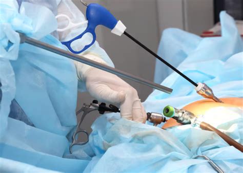 Laparoscopy Sensitive Fertility