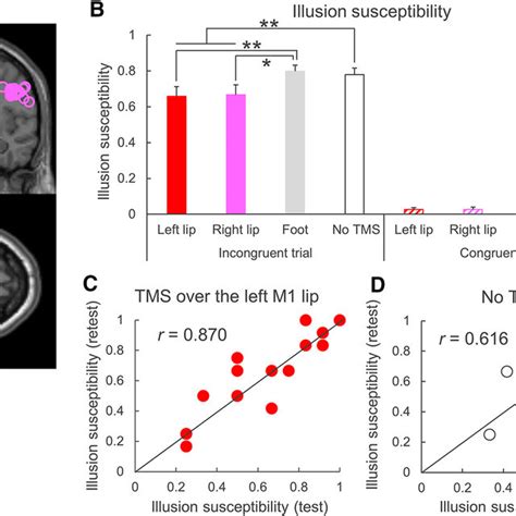 Topographical Tms Effects On Mcgurk Is A Individual Stimulation Sites