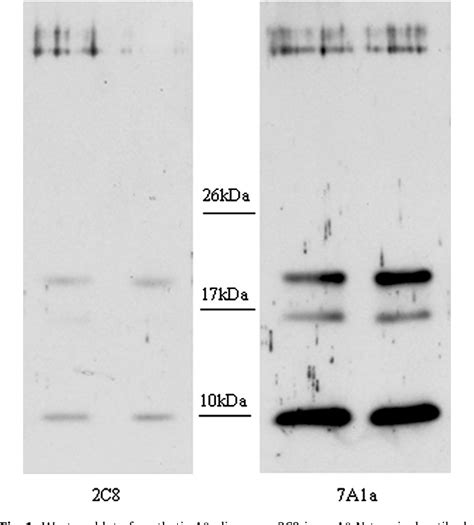 Table 1 From Plasma Amyloid β Oligomers Level Is A Biomarker For Alzheimers Disease Diagnosis