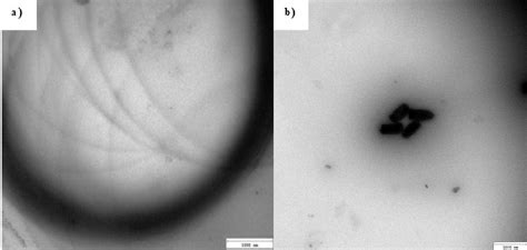 Figure 7 From Design Of Alginate Microsphere Formulation As A Probiotics Carrier Semantic Scholar