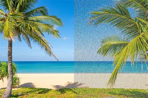 Visual Snow Syndrome Vss University Eye Center Suny College Of