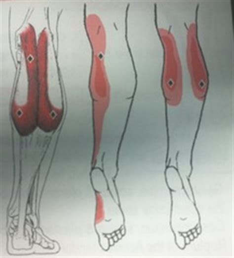 Trigger Points Flashcards Quizlet