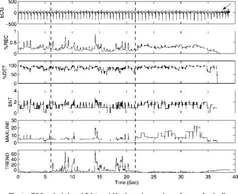 Figure 4 From Recurrence Quantification Analysis As A Tool For Nonlinear Exploration Of