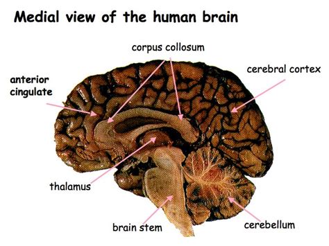 Perception Lecture Notes Neuroimaging