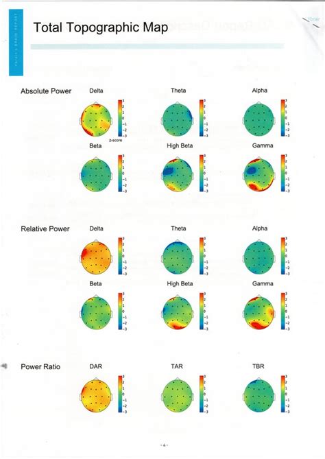 Can Anyone Read My Eeg Brain Scan R Adhs