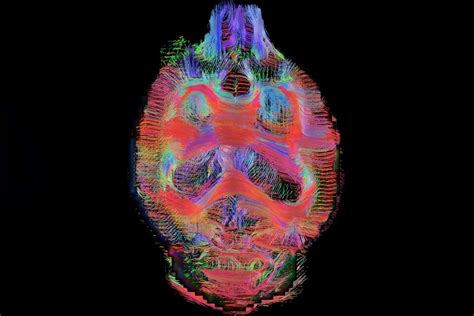 Boosting Brainwaves In Sleep Improves Rats Memory Streamline News