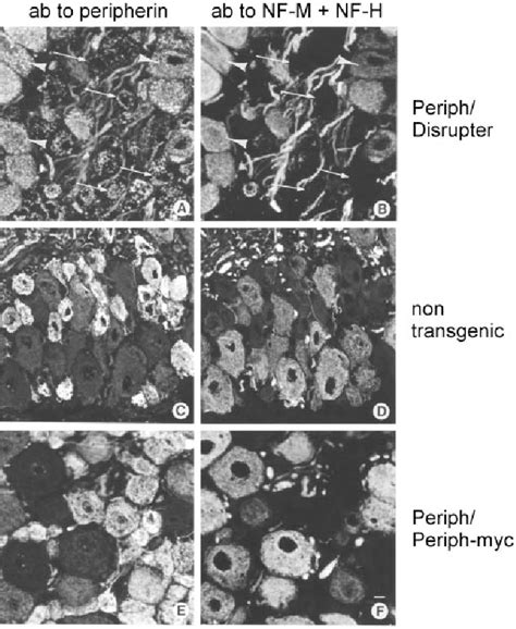 Figure 1 From An Intact Intermediate Filament Network Is Required For