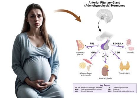 What Is Sheehan Syndrome My Endo Consult