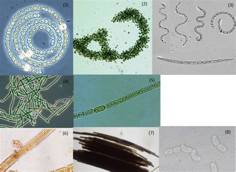 Major Types Of Cyanobacterial Genera 1 Anabaena 2 Microcystis 3
