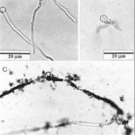 The Effect Of Pseudomonas Spp Strains B194 And B224 On Conidia Download Table