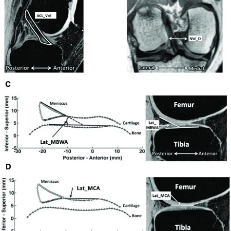 Anatomic Measurements Obtained From Segmentation Of Magnetic Resonance