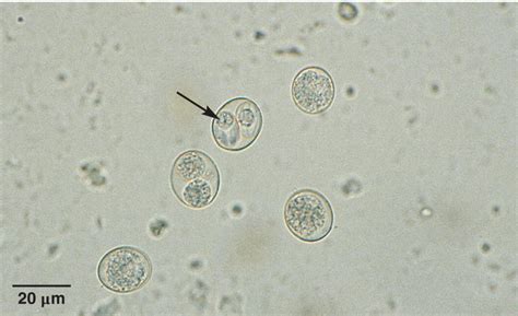 Giardia Cyst In Fecal Float