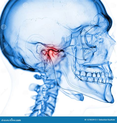The Temporomandibular Joint Royalty Free Cartoon