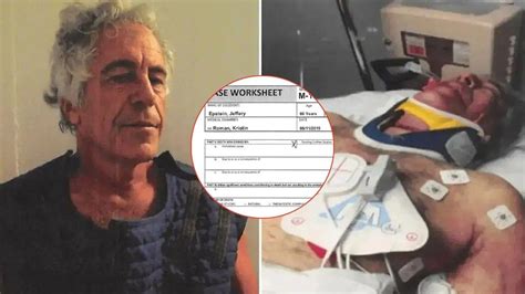 Doctor Who Ruled Epsteins Death A Suicide Finally Speaks Out