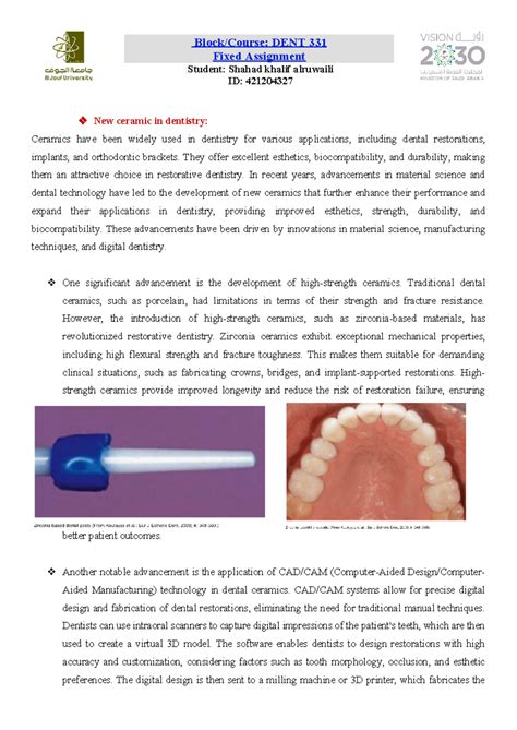 D 331 Fixed Ceramic In Dentistry Assignment New Ceramic In Dentistry