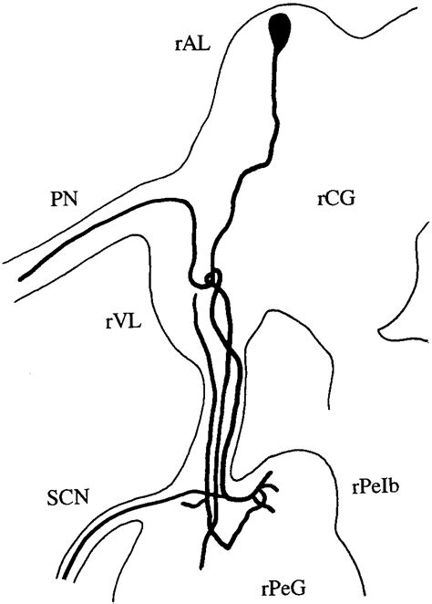 Camera Lucida Drawing Of A Ral Neuron Filled With Lucifer Electrical