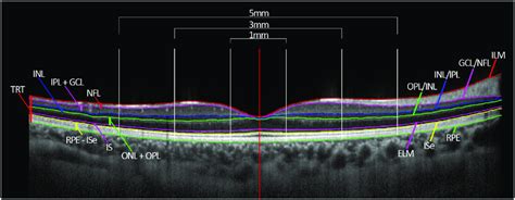 example of the segmentation applied to each macula oct image including download scientific