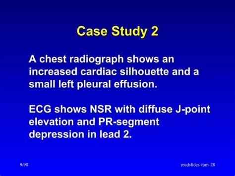 Pericardial Disease Presentation Slidesppt