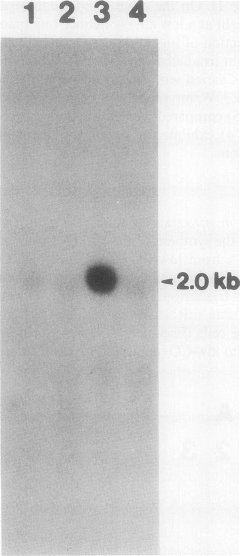 effects of dark incubation and dcmu 1 0qm addition on ca transcript