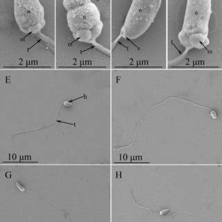 Scanning Electron Micrographs Of The Sperm Of Four Species Shellfish Download Scientific