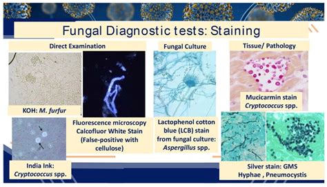 Current And Novel Diagnostics For Invasive Fungal Infections Cimjournal