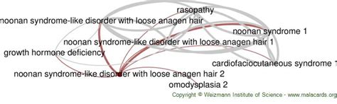 Noonan Syndrome Like Disorder With Loose Anagen Hair 2 Disease Malacards Research Articles