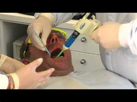 PVS Impressions YouTube