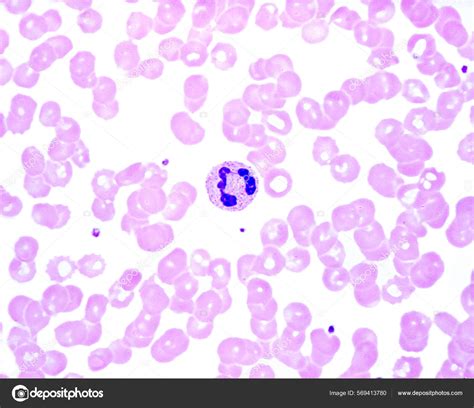 Leukocytes Histology