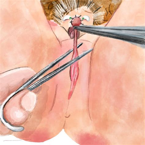 Rule 34 Anime Caption Cartoon Circumcised Clit Removal Clitless