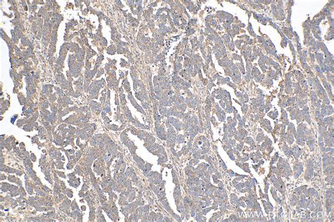 Txnip Antibody 18243 1 Ap Proteintech
