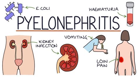 Pyelonephritis Pyelonephritis