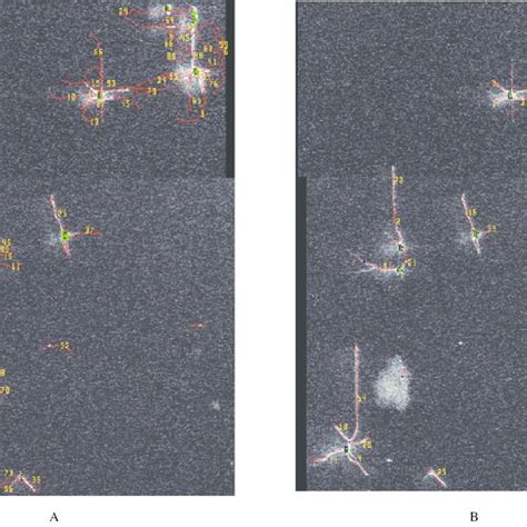 14 Image Analysis Examples Illustrating A Blob Like Objects Nuclei Download Scientific