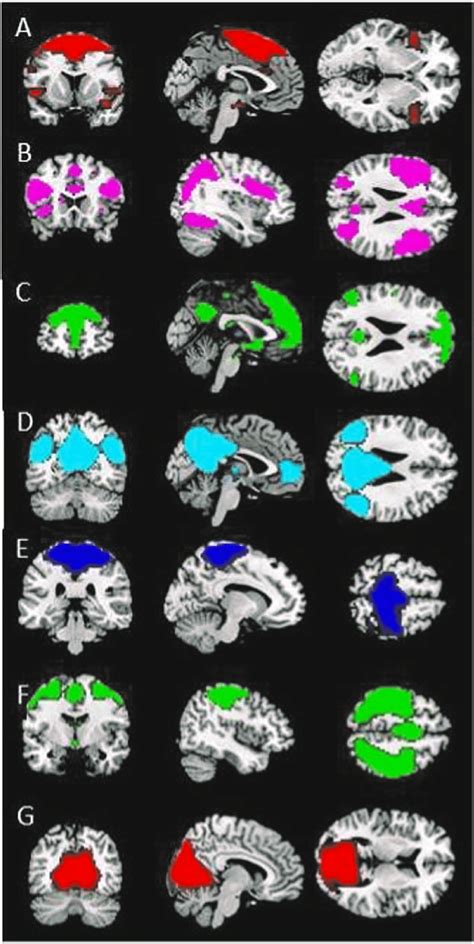 The Spatial Maps Of A The Salience Network R 0 14 B The Download Scientific Diagram