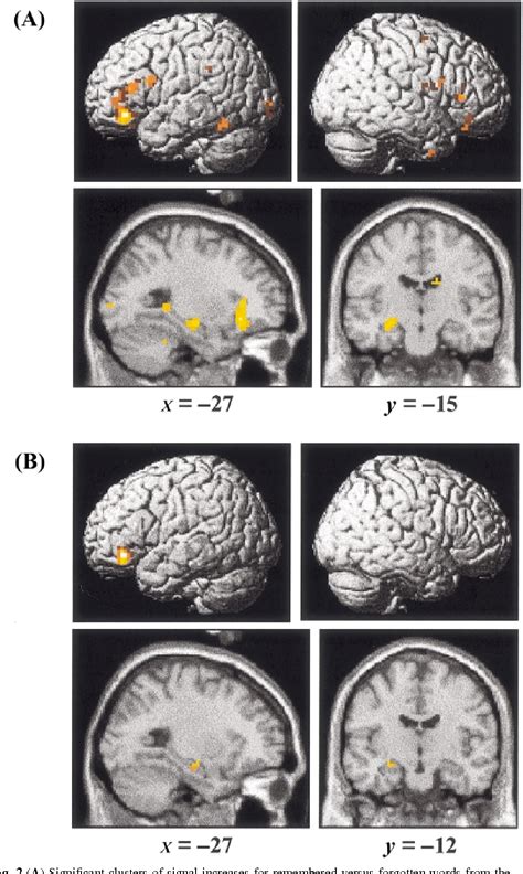 Figure 2 From Depth Of Processing Effects On Neural Correlates Of Memory Encoding Relationship