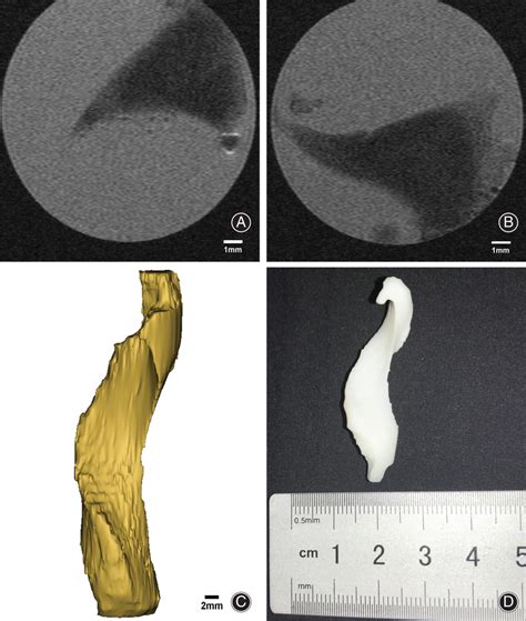 Micro‐mri Based Three‐dimensional 3d Reconstruction A Freshly Download Scientific Diagram