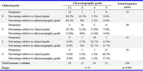 Varicocele Grade 4
