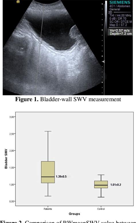 Figure 1 From The Diagnostic Value Of Bladder Wall Thickness And Arfi Elastography Of Bladder