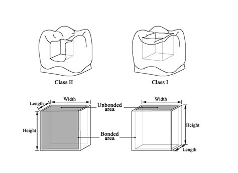 Non Destructive Examination Of Interfacial Debonding In Dental Composite Restorations Using