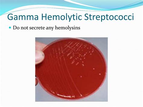 Ppt Hemolytic Streptococci Identification Powerpoint Presentation