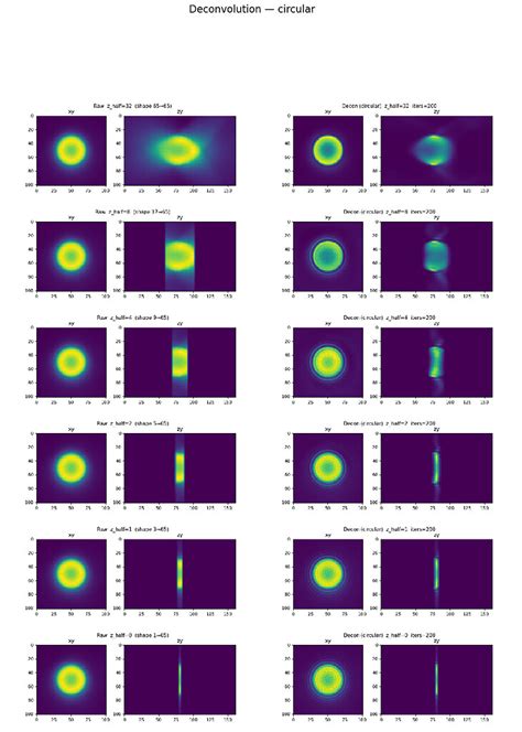 Deconvolve 2d Slice With 3d Deconvolution Image Analysis Imagesc Forum