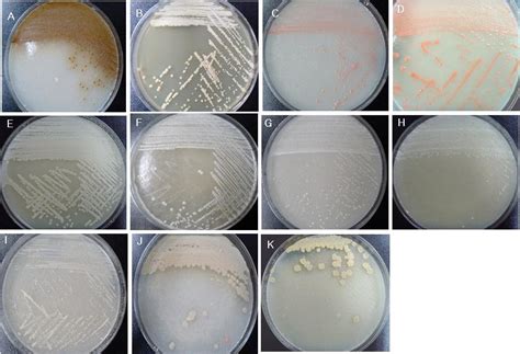 Cryptococcus Colony