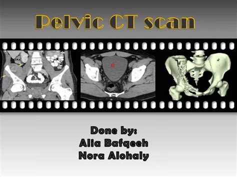 Ct Scan Ppt Free Download Captions Hunter