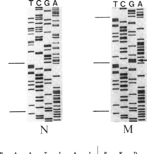 Figure 2 From Noonan Syndrome Semantic Scholar