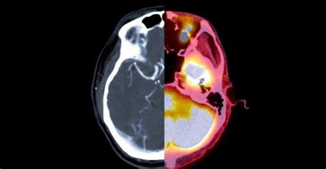 Growing The Galaxies Of Our Brain Growth Mindset And Learning Power
