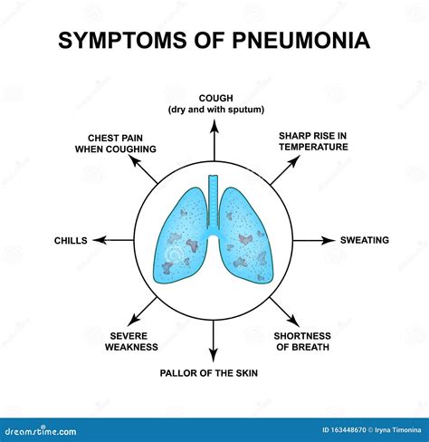 Structure Of The Lungs Cartoon Vector 214513277