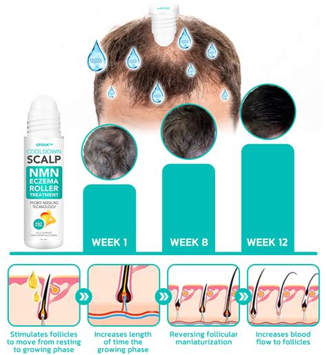 Gfouk™ Cooldownscalp Eczema Treatment Roller Wizzgoo